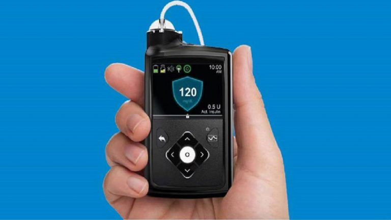 First artificial pancreas for Type 1 diabetics approved by the FDA